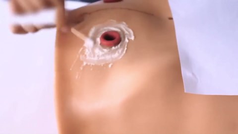 Stoma Powder, Ostomy Skin Care Powder, Protects Skin Keep Dry Ostomy Powder Adapt Stoma Powder (25g)