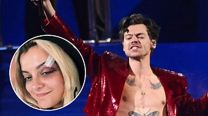 Harry Styles is the latest to be attacked whilst performing on stage, double over in pain after being hit with a flying object during a show in Vienna. | Herald Sun
